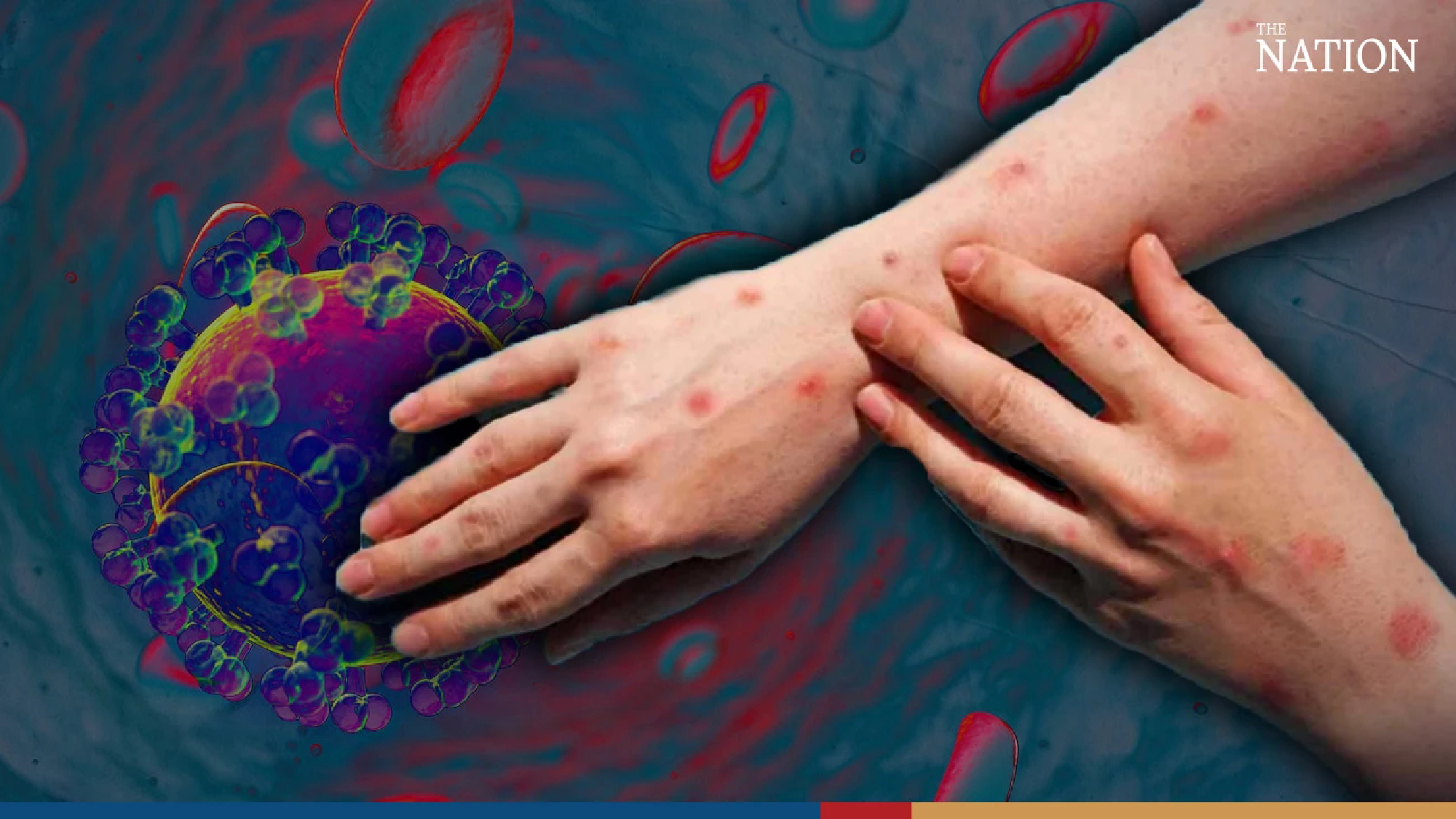 Rise in Monkeypox cases among young people: DDC